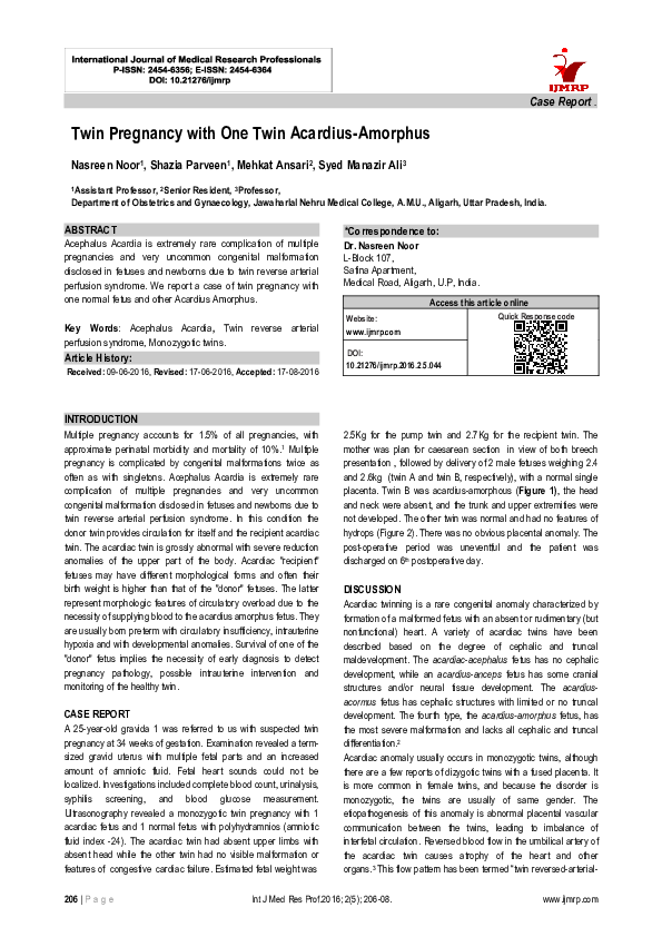 (PDF) Twin Pregnancy with One Twin Acardius-Amorphus