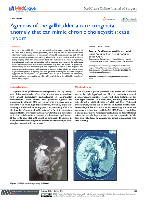 (PDF) Agenesis of the gallbladder, a rare congenital anomaly that can ...