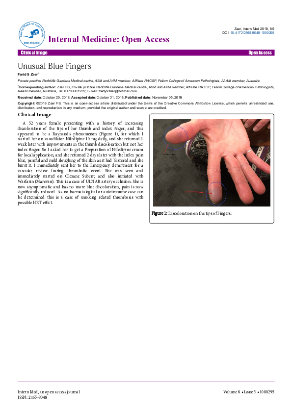 (PDF) Unusual Blue Fingers
