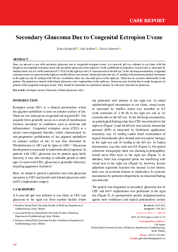(PDF) Secondary Glaucoma Due to Congenital Ectropion Uveae