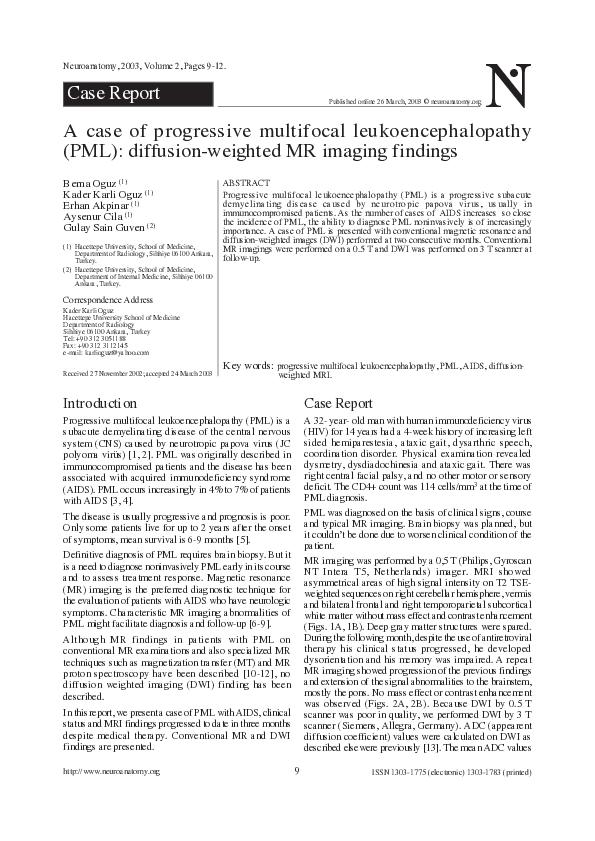 (PDF) A case of progressive multifocal leukoencephalopathy (PML ...