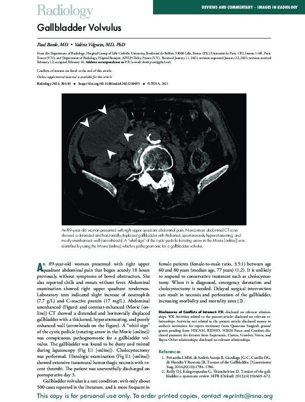 (PDF) Gallbladder Volvulus