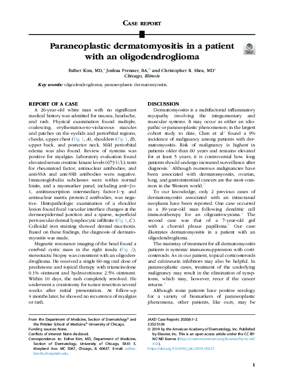 (PDF) Paraneoplastic dermatomyositis in a patient with an oligodendroglioma