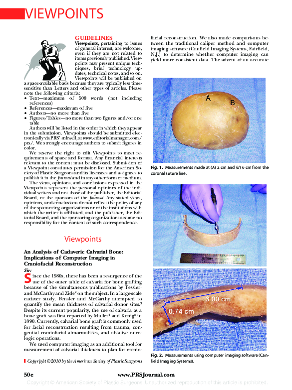 (PDF) Early Excision and Application of Matriderm with Simultaneous ...