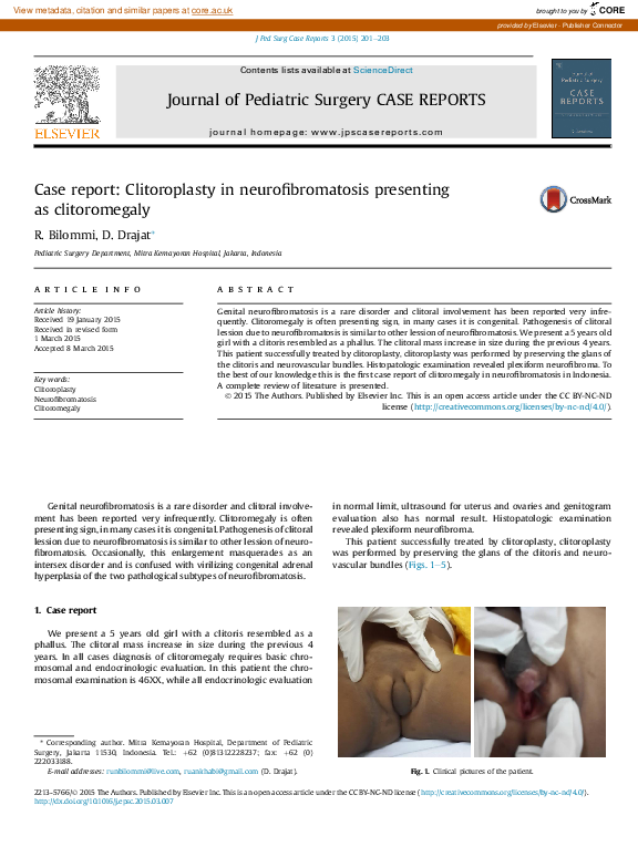 (PDF) Case report: Clitoroplasty in neurofibromatosis presenting as ...