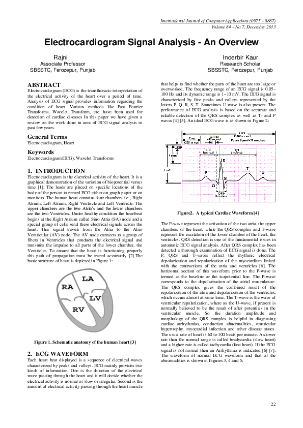 (PDF) Electrocardiogram Signal Analysis - An Overview