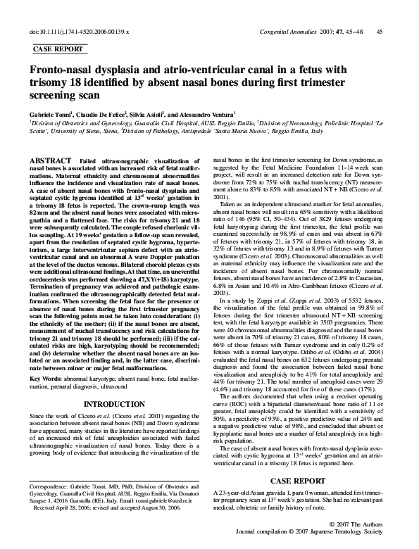 (PDF) Fronto‐nasal dysplasia and atrio‐ventricular canal in a fetus ...