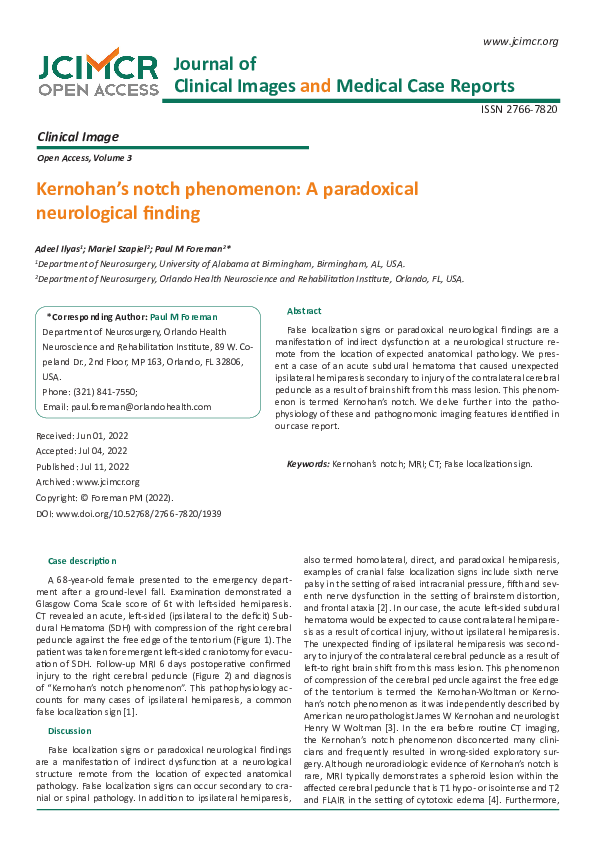 (PDF) Kernohan’s notch phenomenon: A paradoxical neurological finding