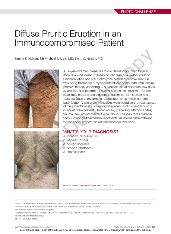 (PDF) Diffuse Pruritic Eruption in an Immunocompromised Patient