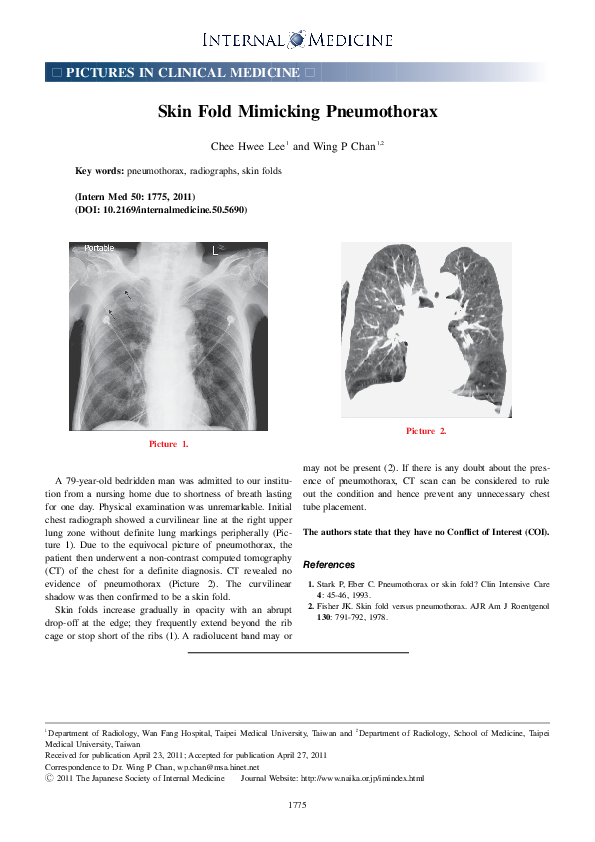 (PDF) Skin Fold Mimicking Pneumothorax