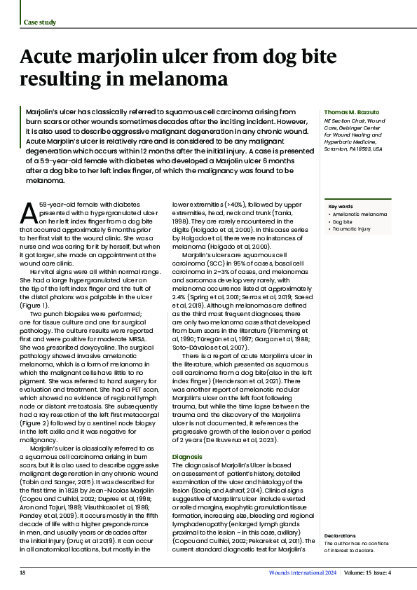 (PDF) Acute marjolin ulcer from dog bite resulting in melanoma