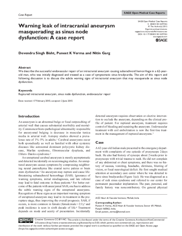 (PDF) Warning leak of intracranial aneurysm masquerading as sinus node ...
