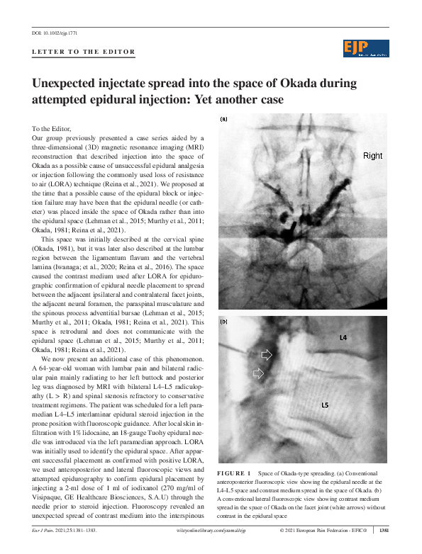 (PDF) Unexpected injectate spread into the space of Okada during ...