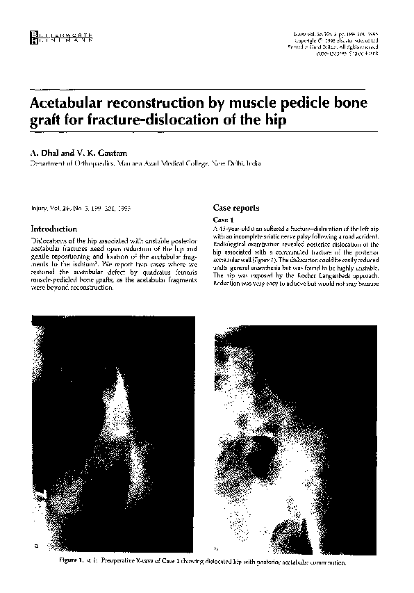 (PDF) Acetabular reconstruction by muscle pedicle bone graft for ...