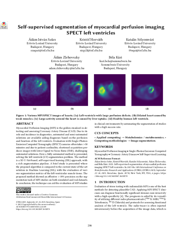 (PDF) Self-supervised segmentation of myocardial perfusion imaging ...