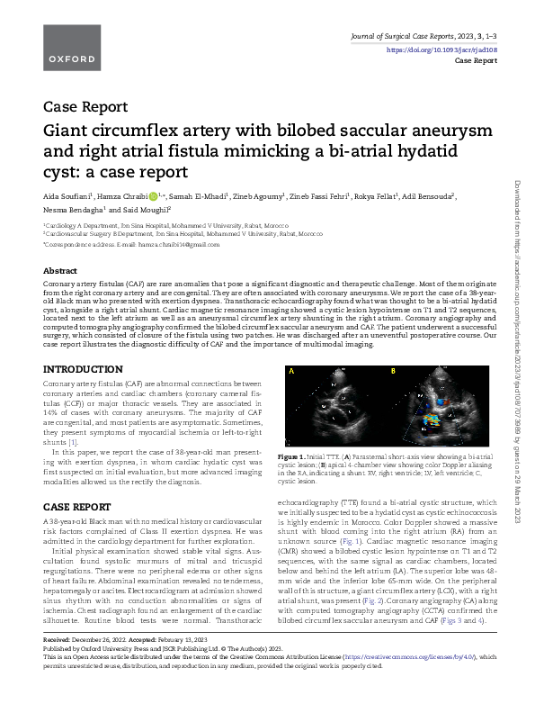 (PDF) Giant circumflex artery with bilobed saccular aneurysm and right ...