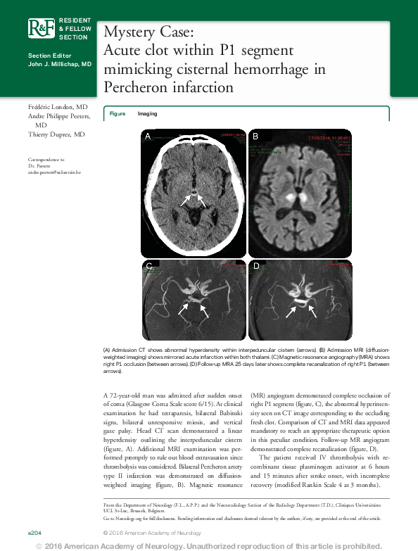 (PDF) Mystery Case: Acute clot within P1 segment mimicking cisternal ...