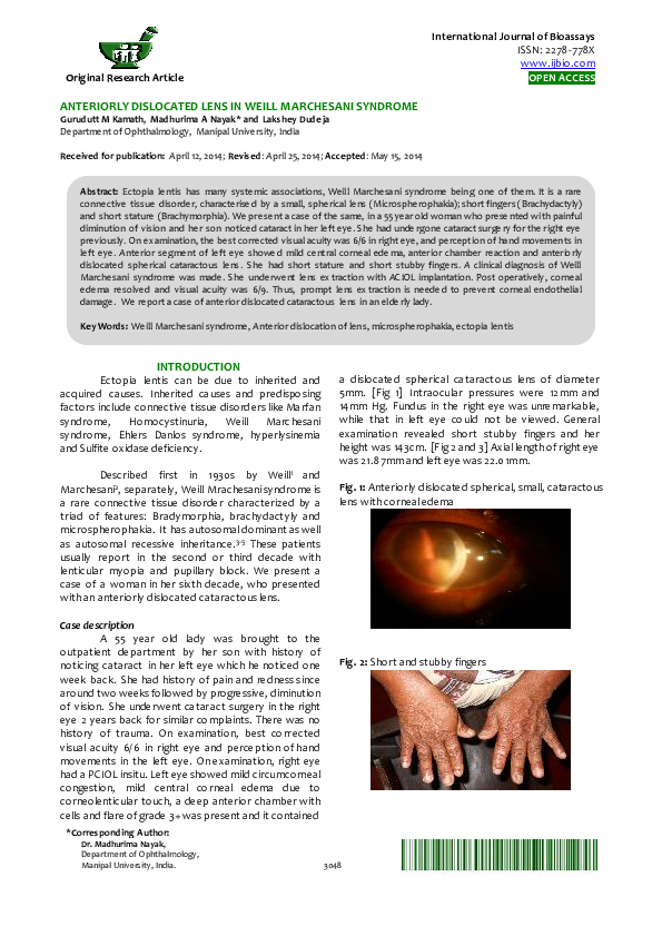 (PDF) Anteriorly Dislocated Lens in Weill Marchesani Syndrome