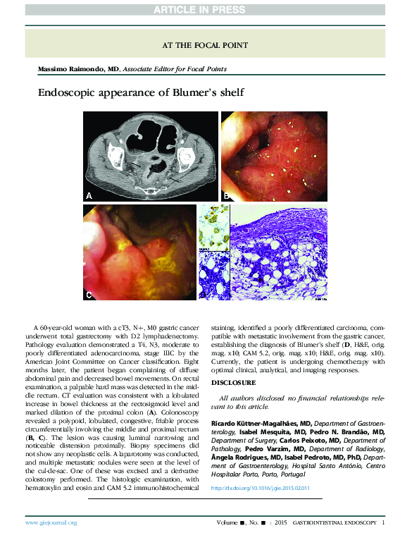 (PDF) Endoscopic appearance of Blumer's shelf