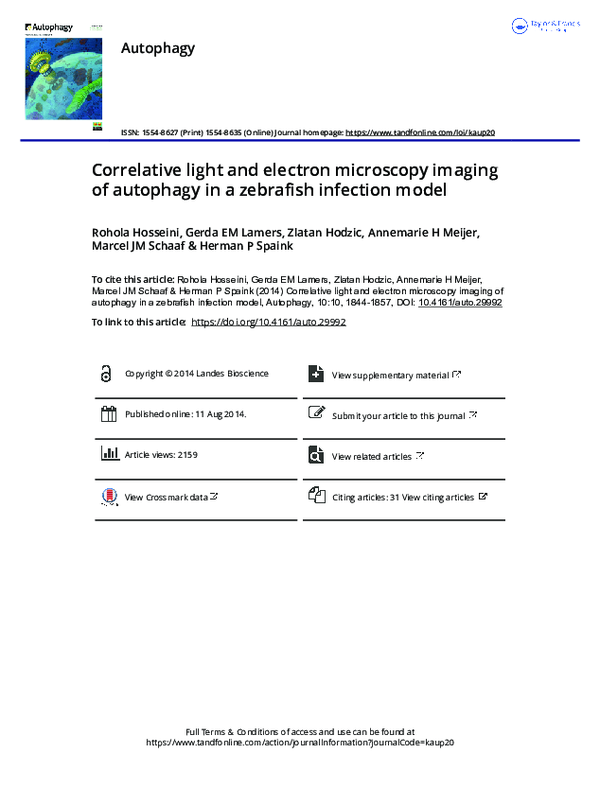 (PDF) Correlative light and electron microscopy imaging of autophagy in ...