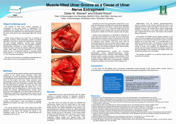 (PDF) Muscle-filled Ulnar Groove as a Cause of Ulnar Nerve Entrapment