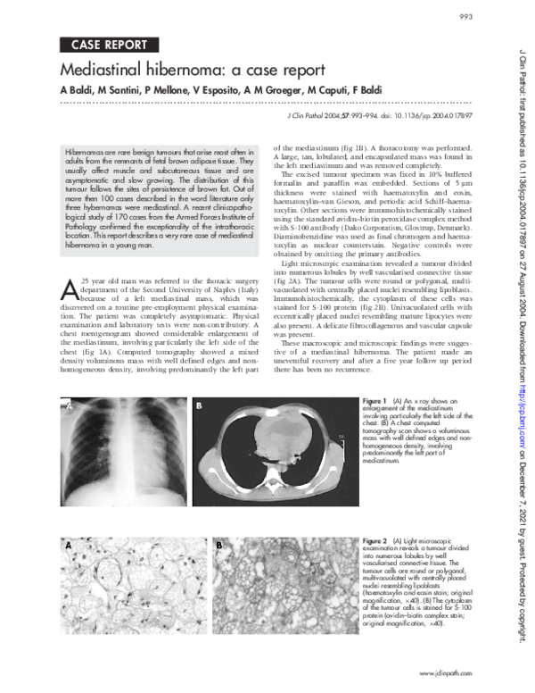 (PDF) Mediastinal hibernoma: a case report