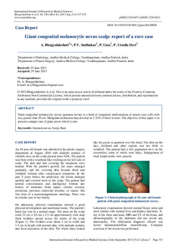 (PDF) Giant congenital melanocytic nevus scalp: report of a rare case