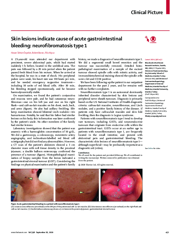 (PDF) Skin lesions indicate cause of acute gastrointestinal bleeding ...