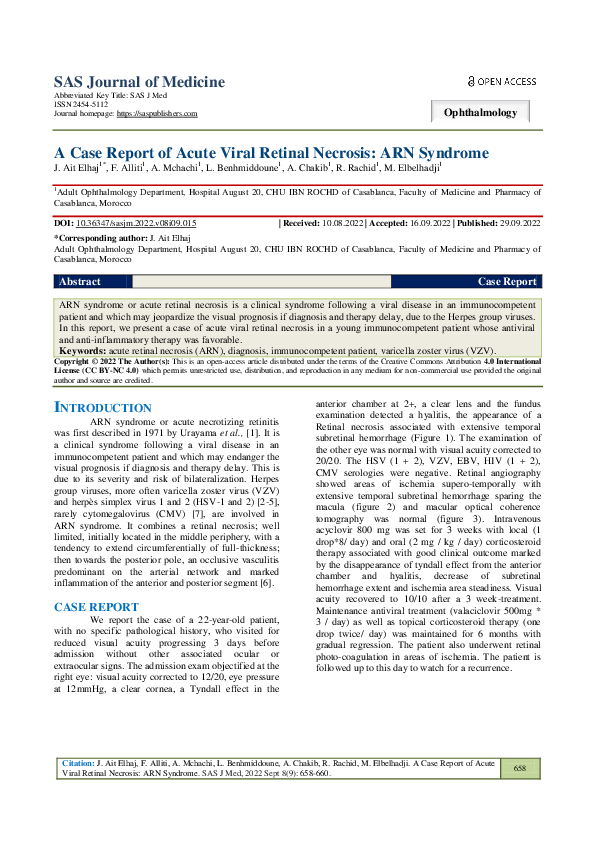 (PDF) A Case Report of Acute Viral Retinal Necrosis: ARN Syndrome