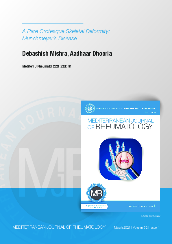 (PDF) A Rare Grotesque Skeletal Deformity: Munchmeyer’s Disease