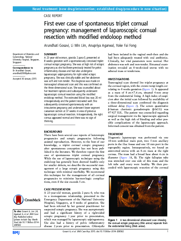 (PDF) First ever case of spontaneous triplet cornual pregnancy ...