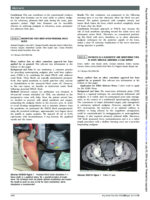 (PDF) #36316 Tap-block as a diagnostic and monitoring tool in acute ...