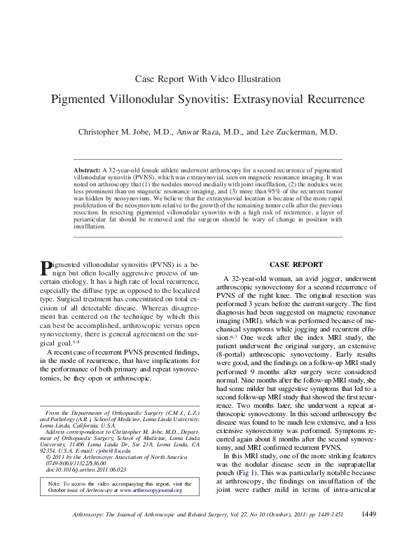 (PDF) Pigmented Villonodular Synovitis: Extrasynovial Recurrence