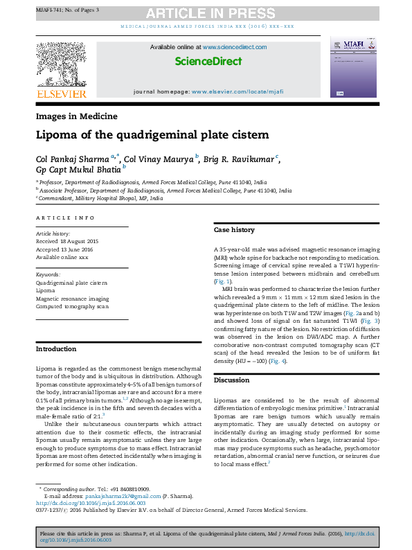 (PDF) Lipoma of the quadrigeminal plate cistern