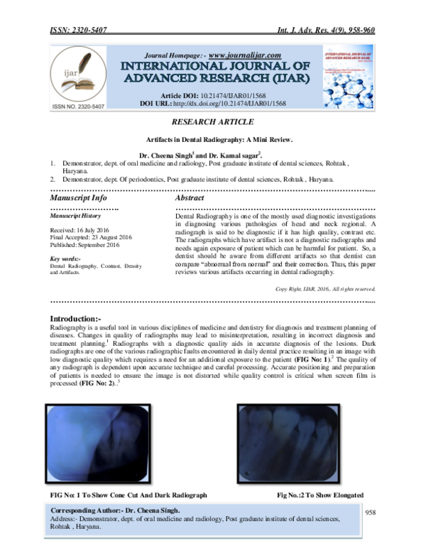 (PDF) Artifacts in Dental Radiography: A Mini Review
