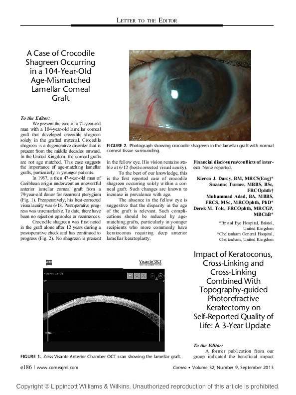 (PDF) A Case of Crocodile Shagreen Occurring in a 104-Year-Old Age ...