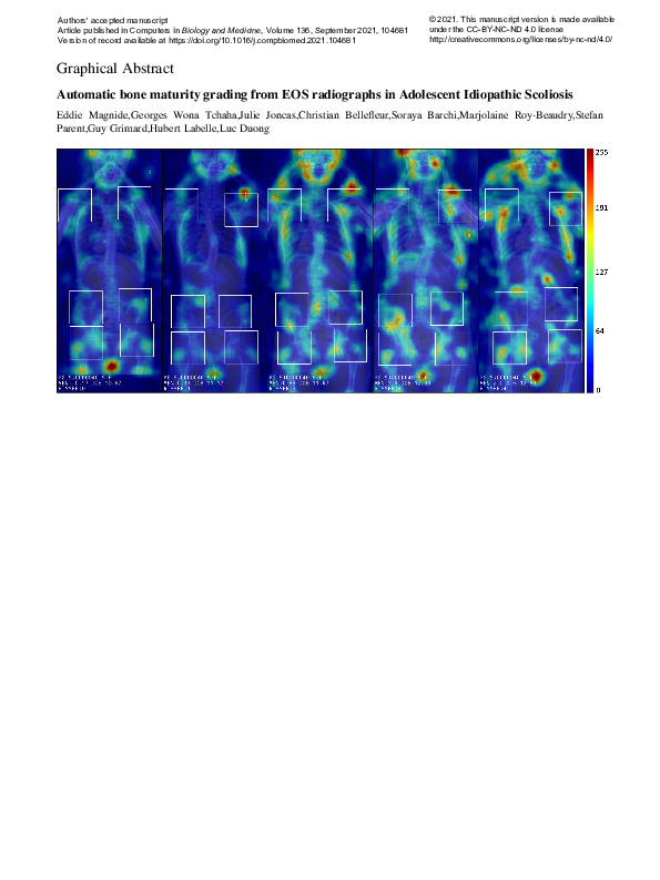 (PDF) Automatic bone maturity grading from EOS radiographs in ...