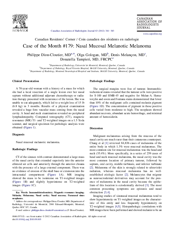 (PDF) Case of the Month #179: Nasal Mucosal Melanotic Melanoma