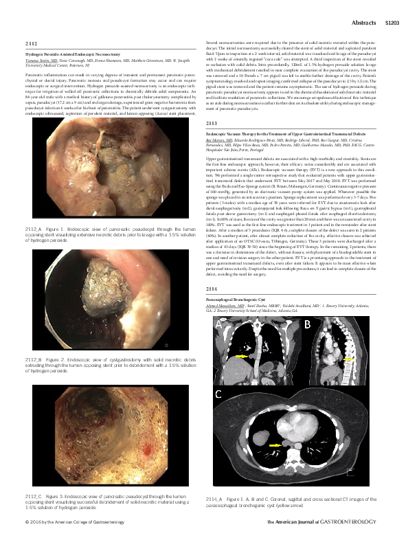 (PDF) Endoscopic Vacuum Therapy for the Treatment of Upper ...