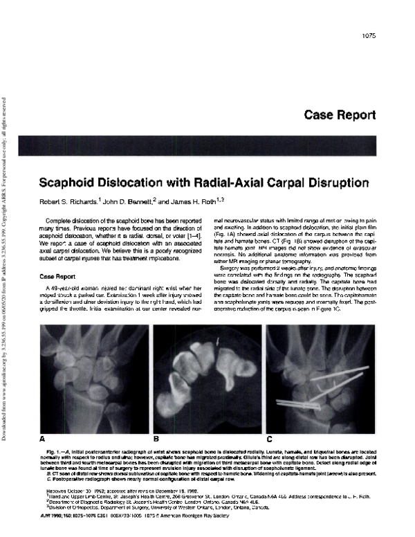 (PDF) Scaphoid dislocation with radial-axial carpal disruption