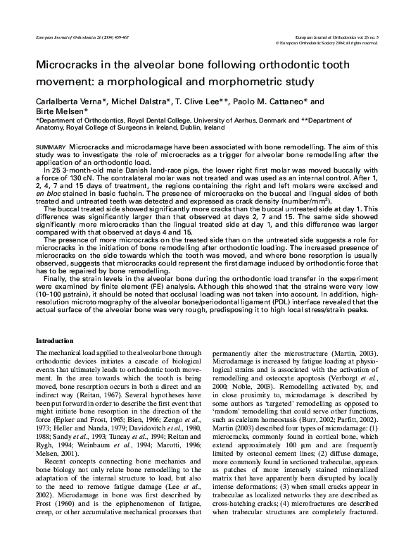 (PDF) Microcracks in the alveolar bone following orthodontic tooth ...