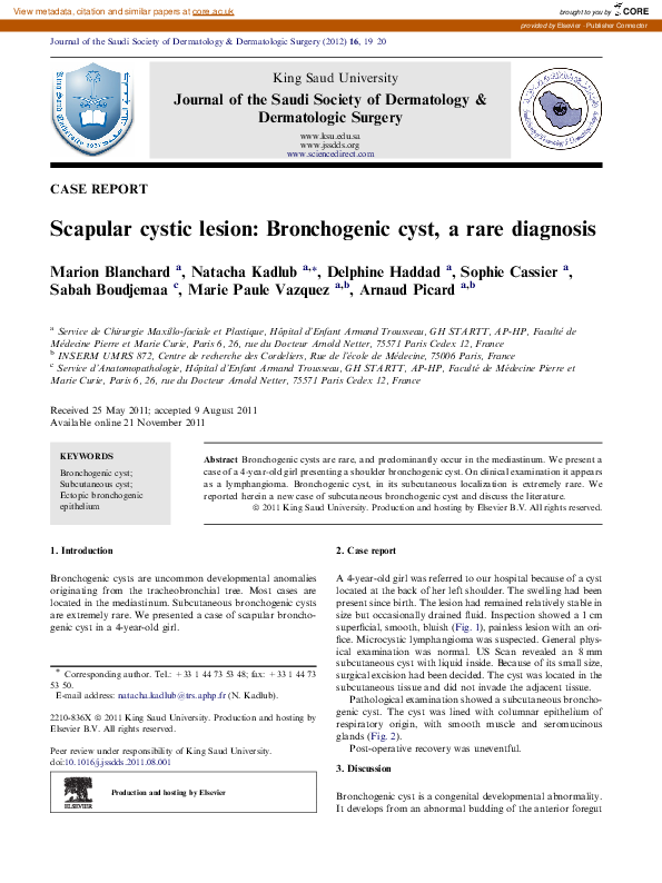Scapular cystic lesion: Bronchogenic cyst, a rare diagnosis