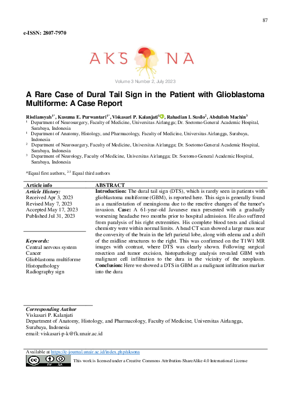 A Rare Case of Dural Tail Sign in the Patient with Glioblastoma ...