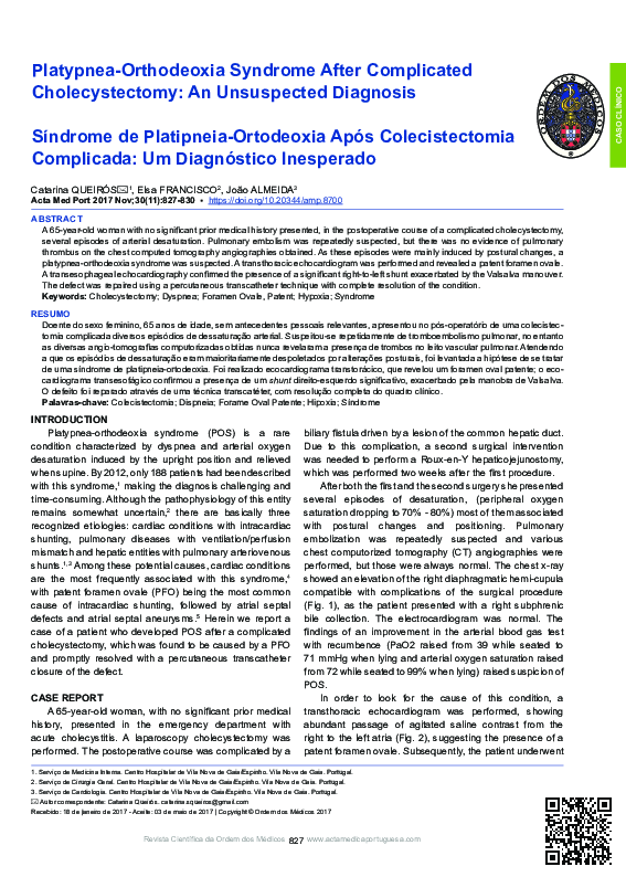 (PDF) Platypnea-Orthodeoxia Syndrome After Complicated Cholecystectomy ...