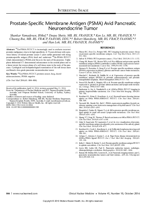 (PDF) Prostate-Specific Membrane Antigen (PSMA) Avid Pancreatic ...