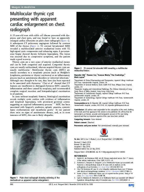 (PDF) Multilocular thymic cyst presenting with apparent cardiac ...