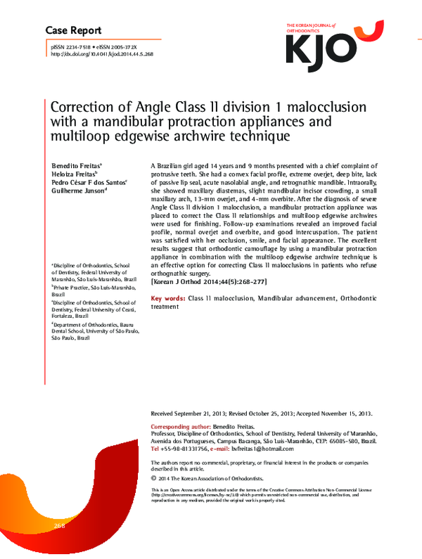 (PDF) Correction of Angle Class II division 1 malocclusion with a ...