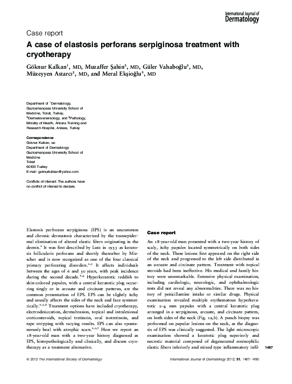 (PDF) A case of elastosis perforans serpiginosa treatment with cryotherapy