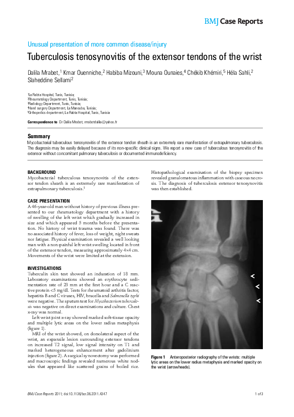 (PDF) Tuberculosis tenosynovitis of the extensor tendons of the wrist