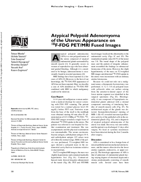(PDF) Atypical Polypoid Adenomyoma of the Uterus: Appearance on 18 F ...